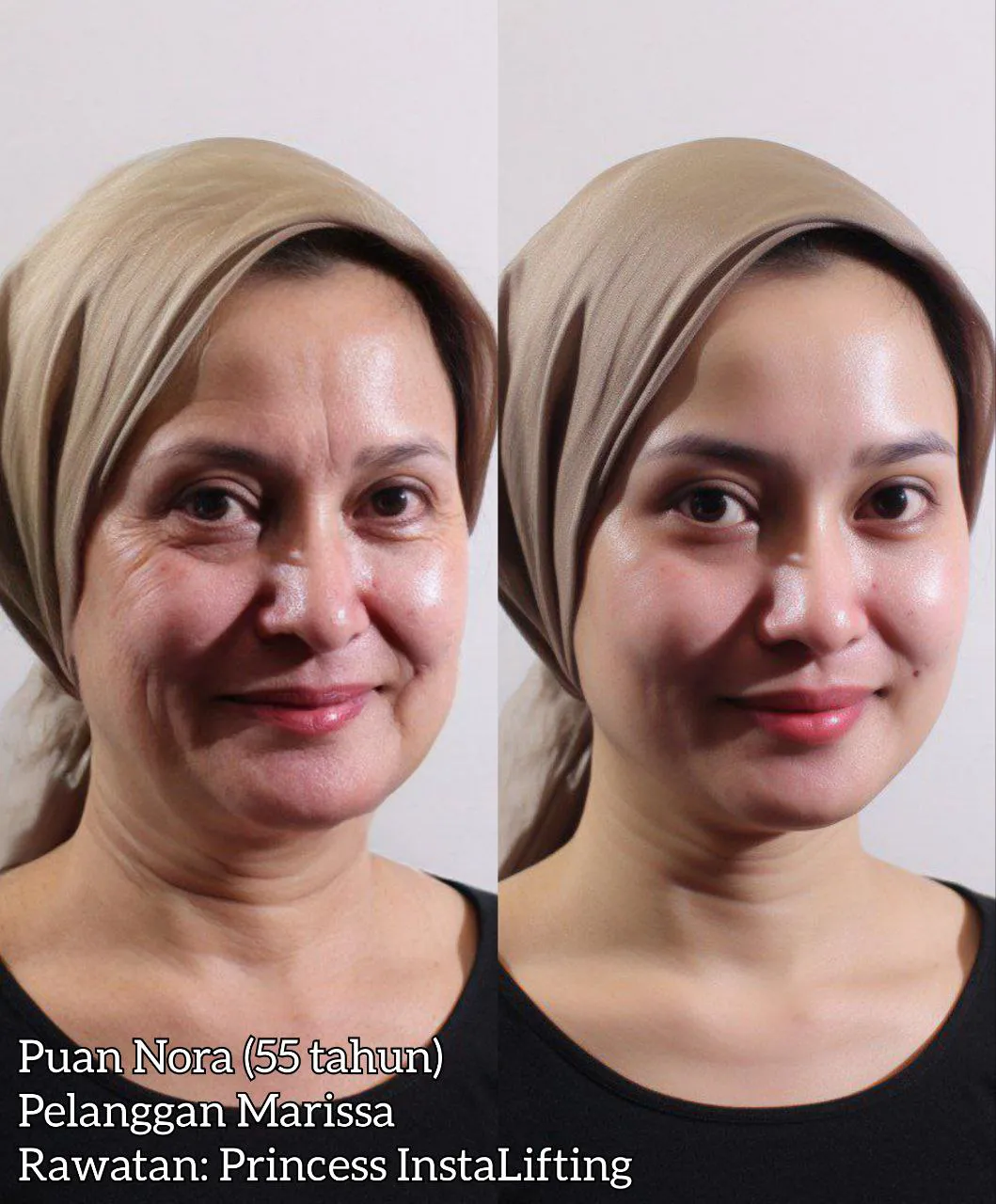 Princess Instalifting – Marissa Aesthetic & Wellness